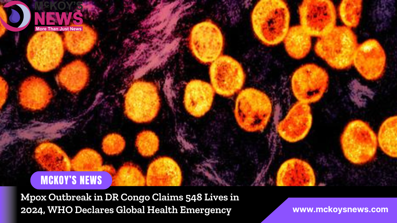 Mpox Outbreak in DR Congo Claims 548 Lives in 2024, WHO Declares Global ...